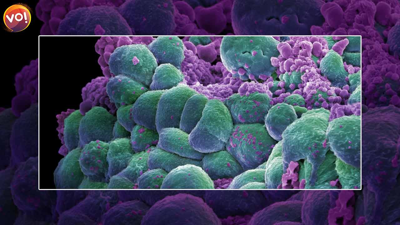 Self-Testing Kit All Set to Help Women Fight Cancer